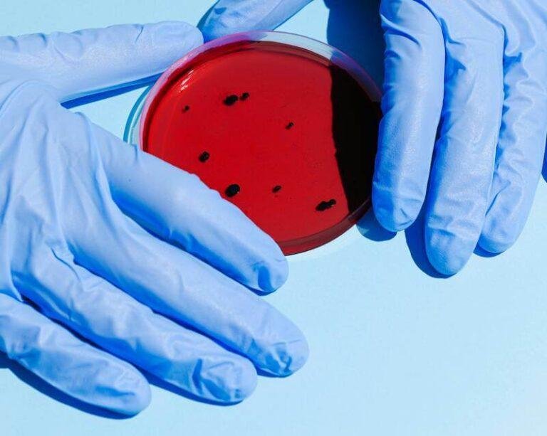 Hoitamaton Kondylooma - Riskit ja seuraukset » Maidonkeraaja.fi